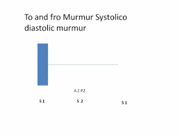 英和画像辞典：(to and fro)の関連画像一覧！