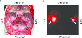 英和画像辞典：(penitrate)の関連画像一覧！