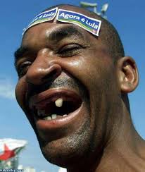 英和画像辞典：(toothless gum)の関連画像一覧！ – おもしろい英文法